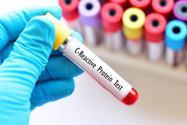Understanding C-Reactive Protein: The Link Between Inflammation and ...